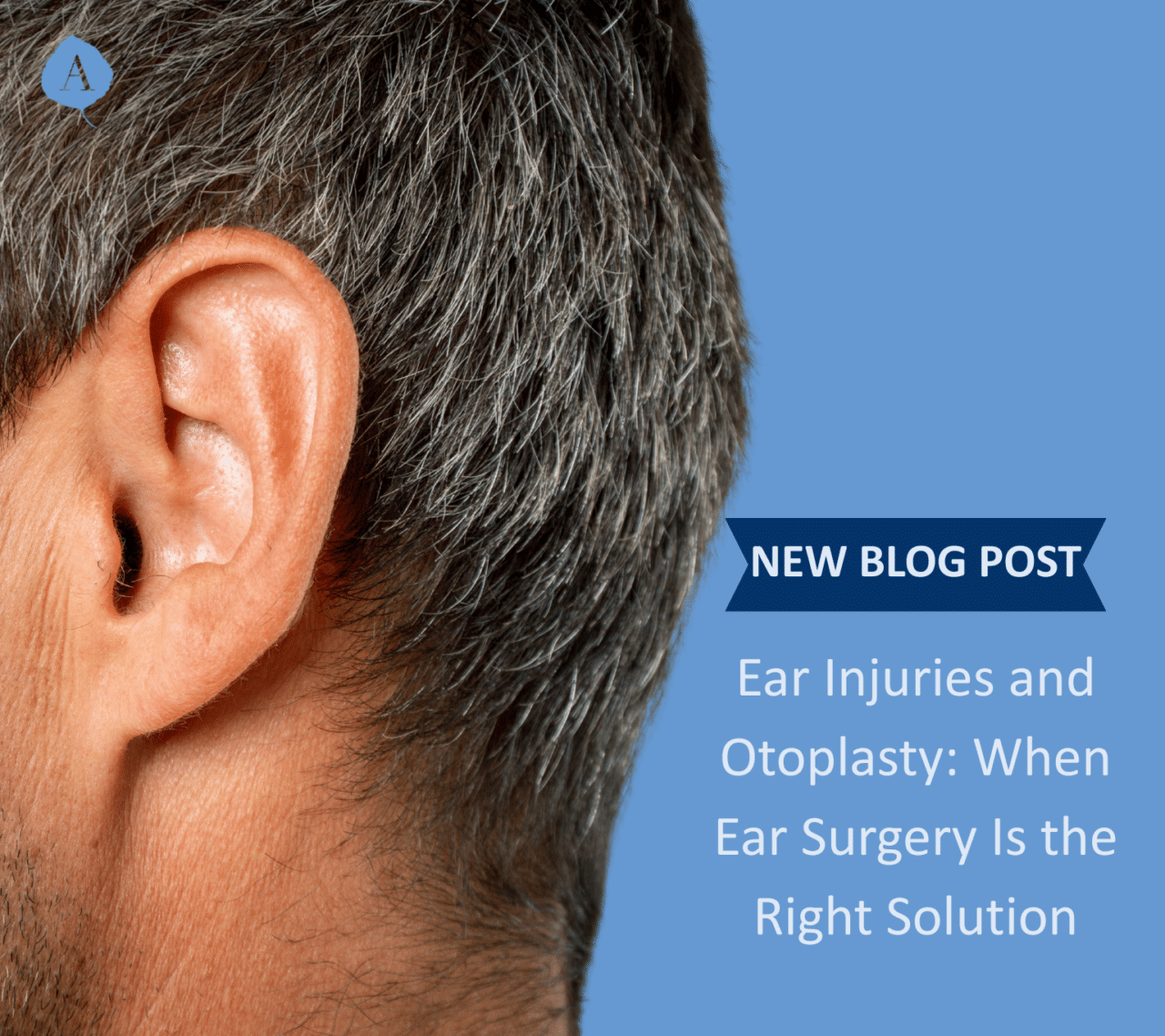 Otoplasty & Ear Pinning Surgery | Utah Facial Plastic Surgery